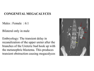 Embryology of kidney | PPTX