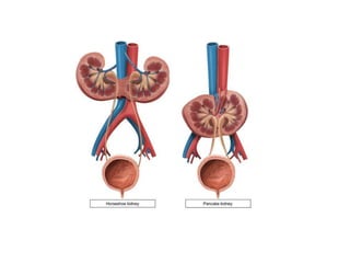 EMBRYOLOGY OF KUB AND ITS CINICAL SIGNIFICANY(1).pptx