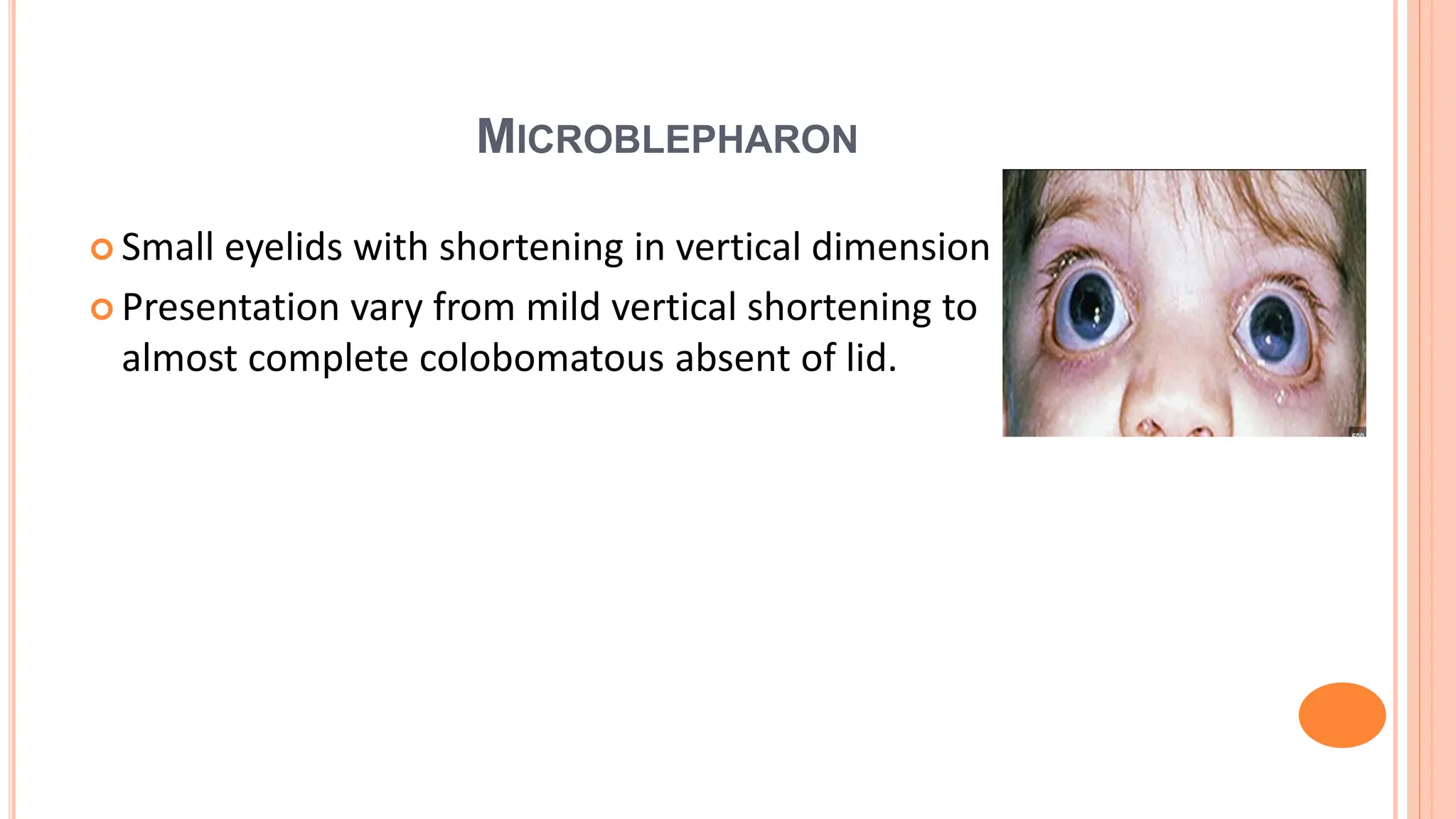 embryology of lids and adnexa.pptx embryology | PPTX