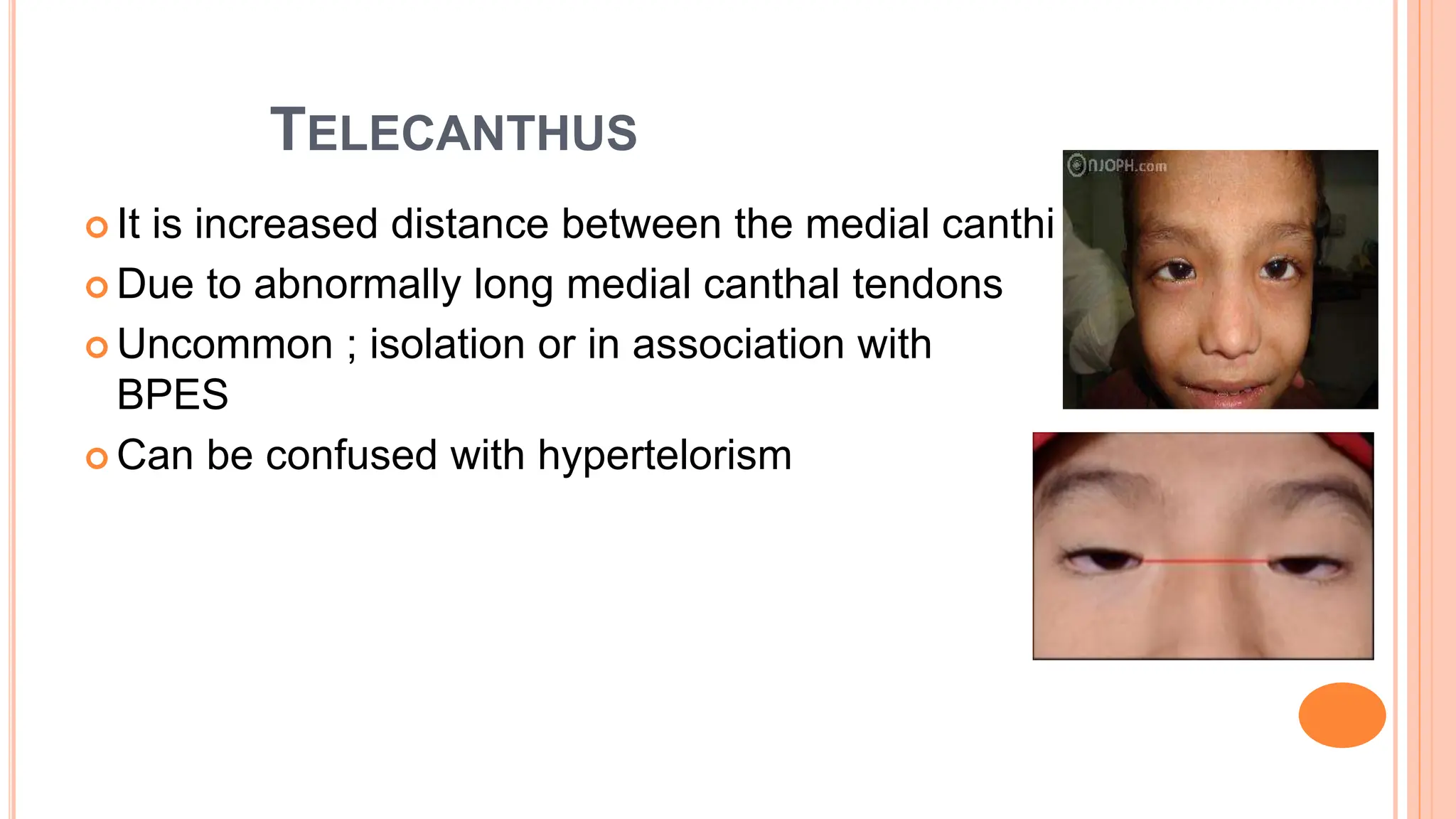 embryology of lids and adnexa.pptx embryology | PPTX