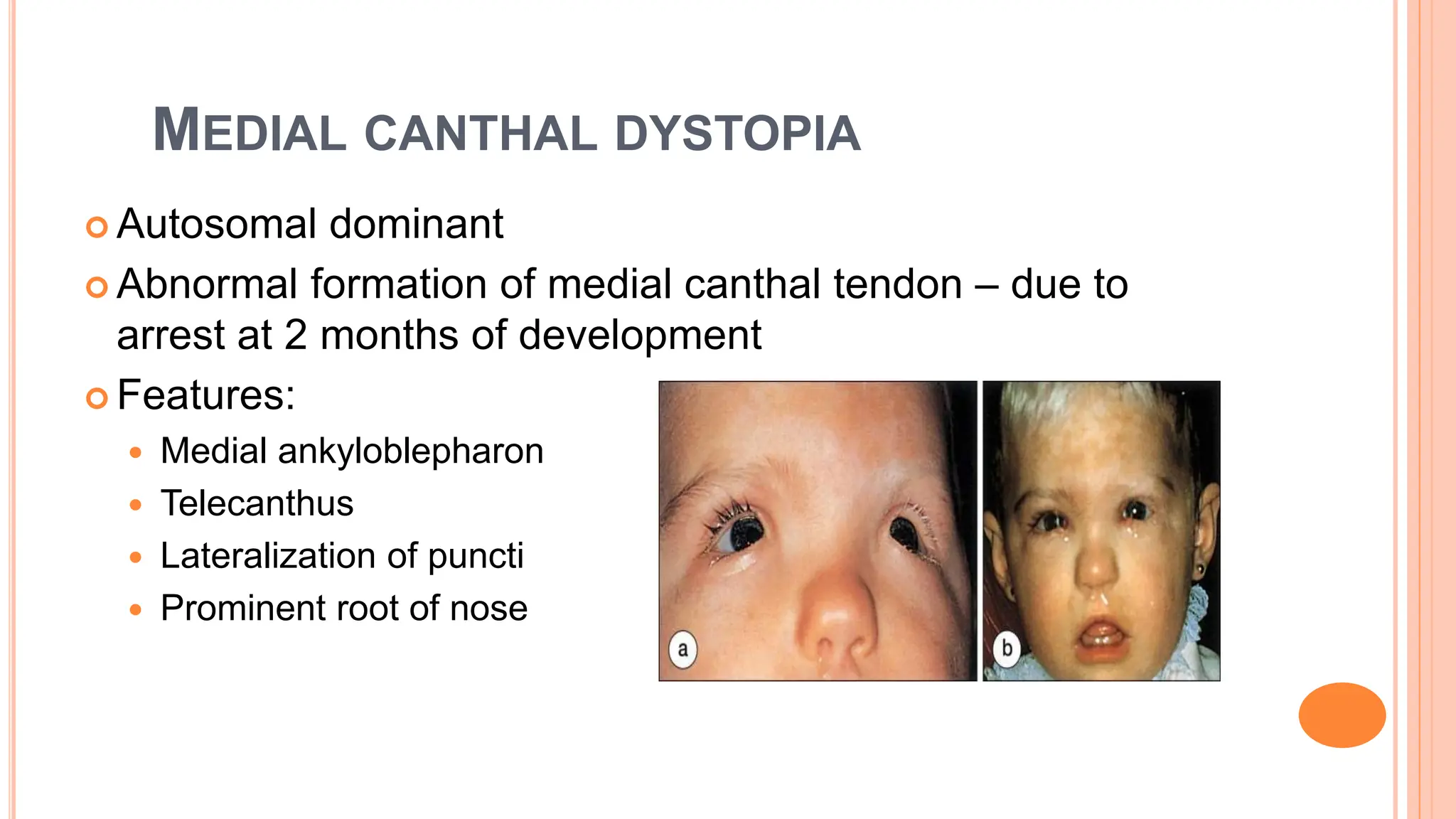 embryology of lids and adnexa.pptx embryology | PPTX