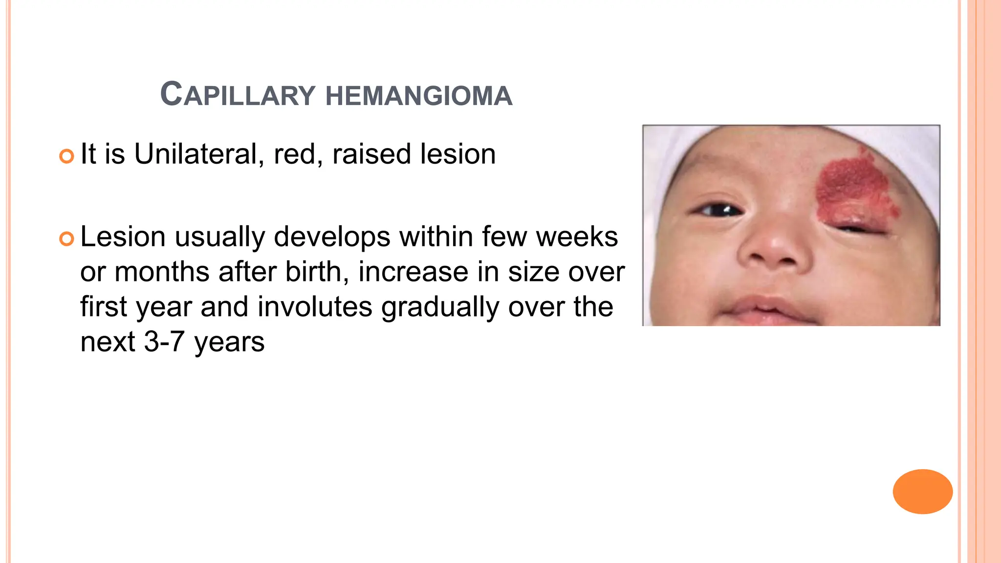 embryology of lids and adnexa.pptx embryology | PPTX