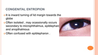embryology of lids and adnexa.pptx embryology | PPTX