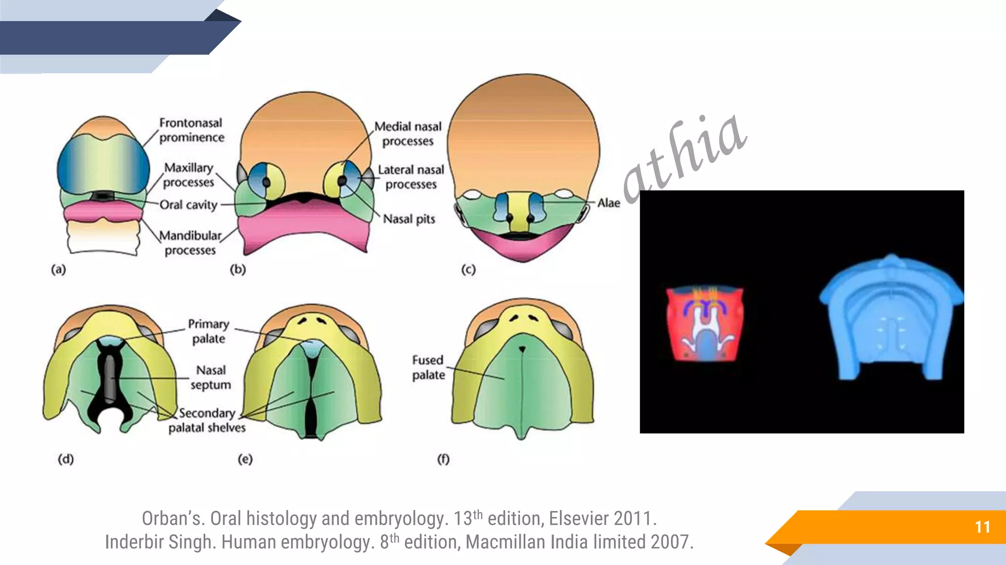 Embryology of Maxilla, Palate, Maxillary sinus & Lips and their Defects ...