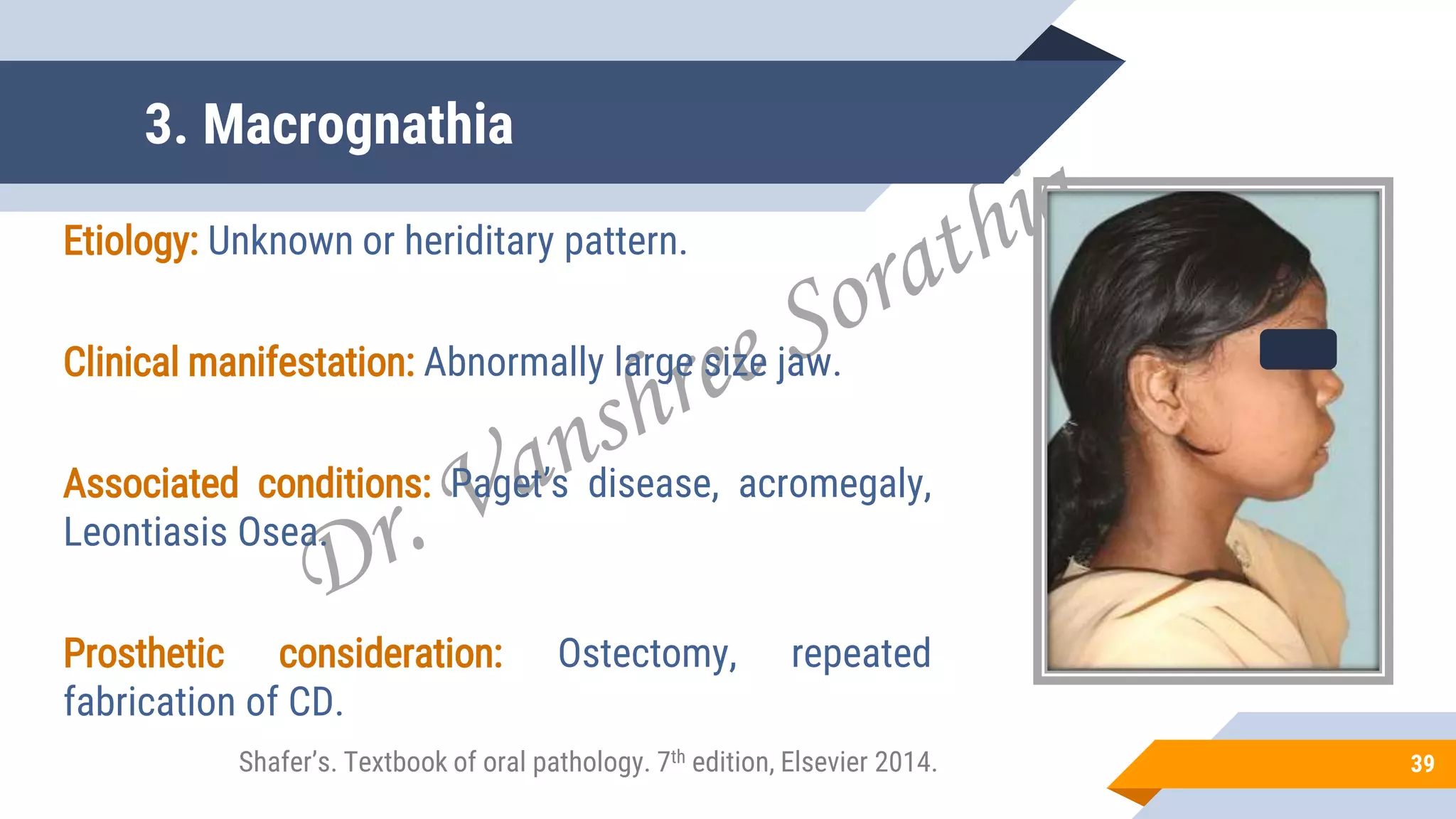 Embryology of Maxilla, Palate, Maxillary sinus & Lips and their Defects ...