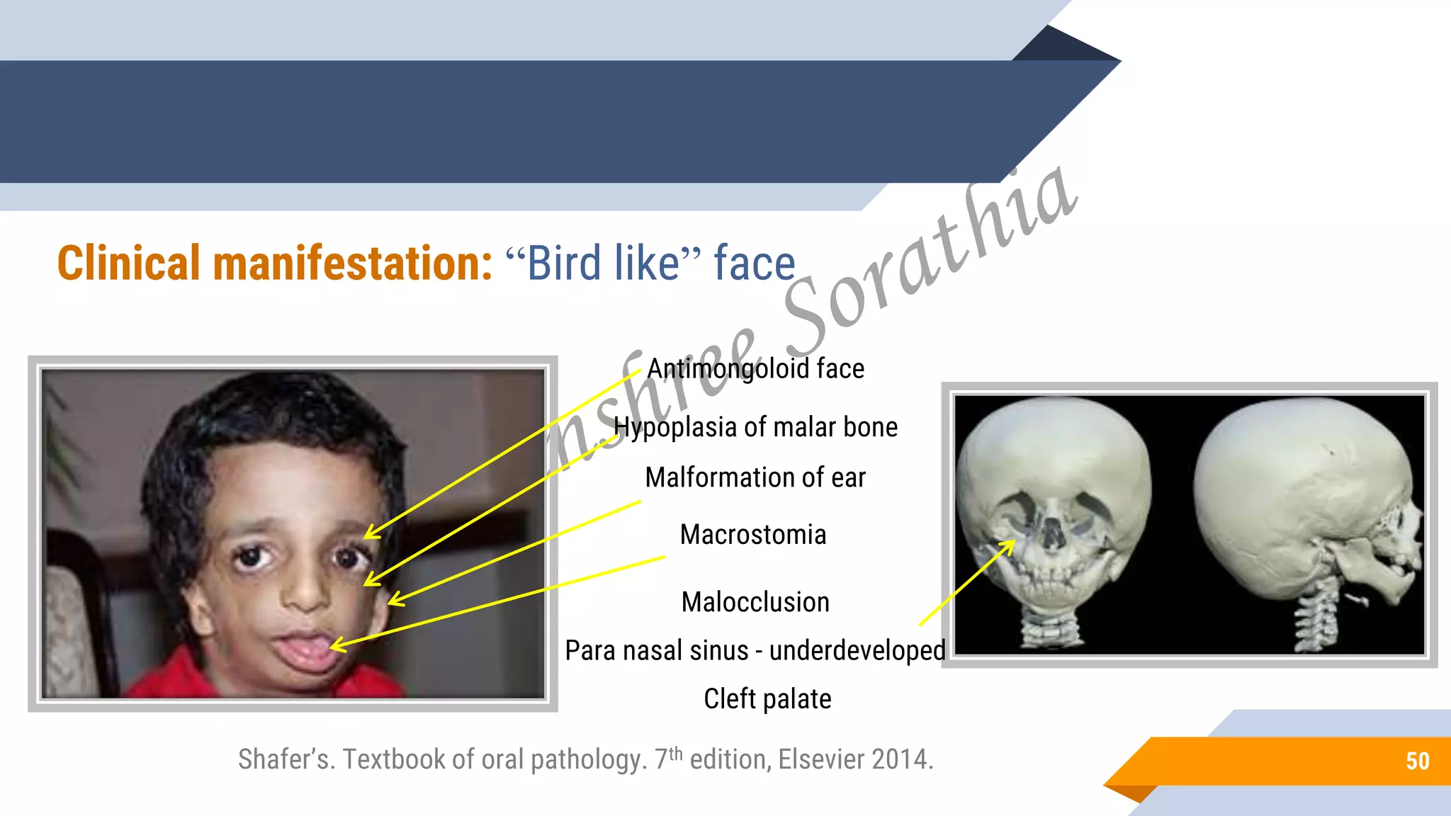Embryology of Maxilla, Palate, Maxillary sinus & Lips and their Defects ...