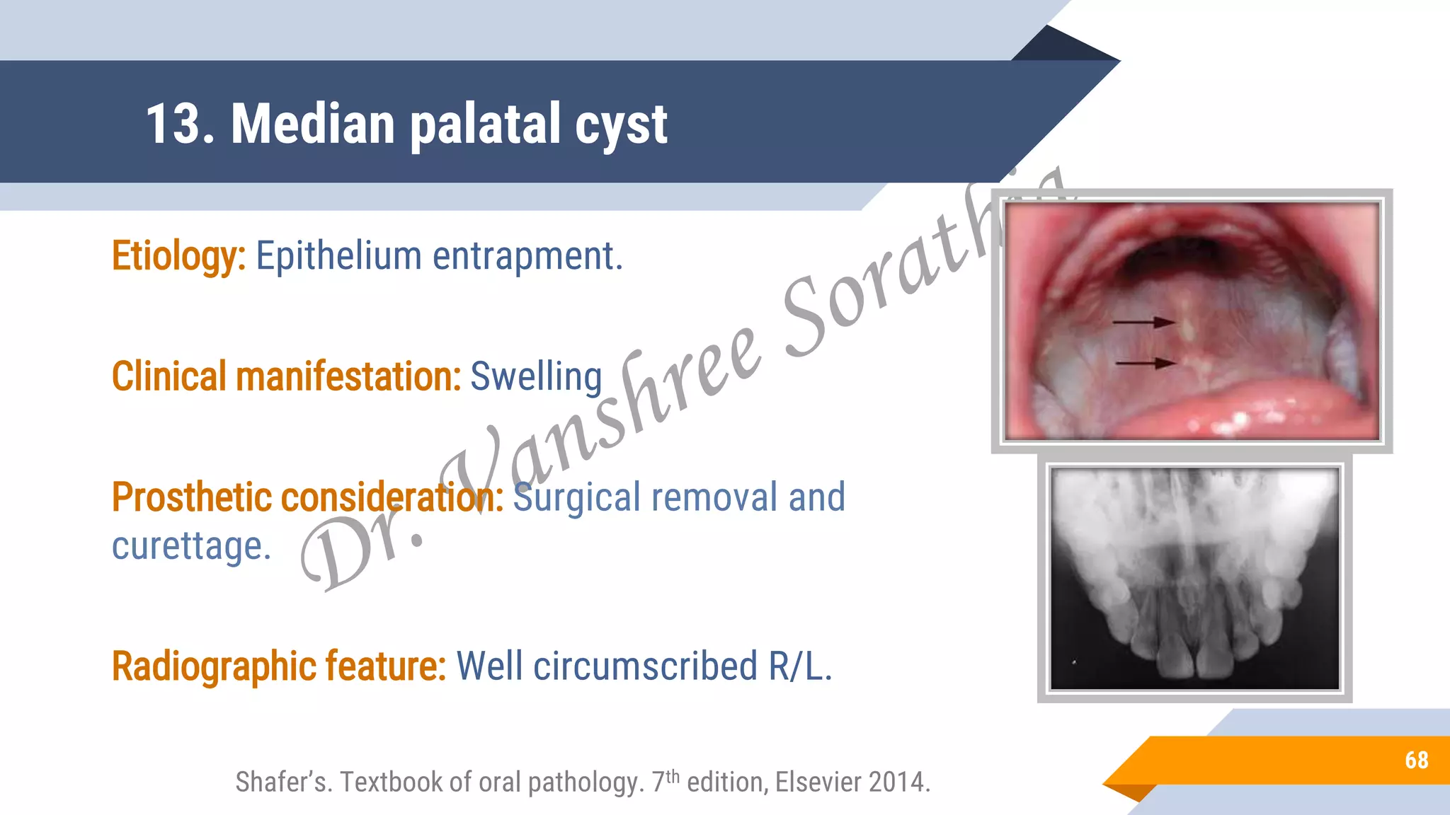 Embryology of Maxilla, Palate, Maxillary sinus & Lips and their Defects ...