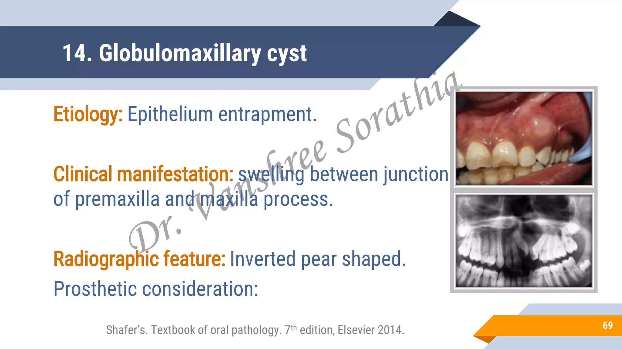 Embryology of Maxilla, Palate, Maxillary sinus & Lips and their Defects ...