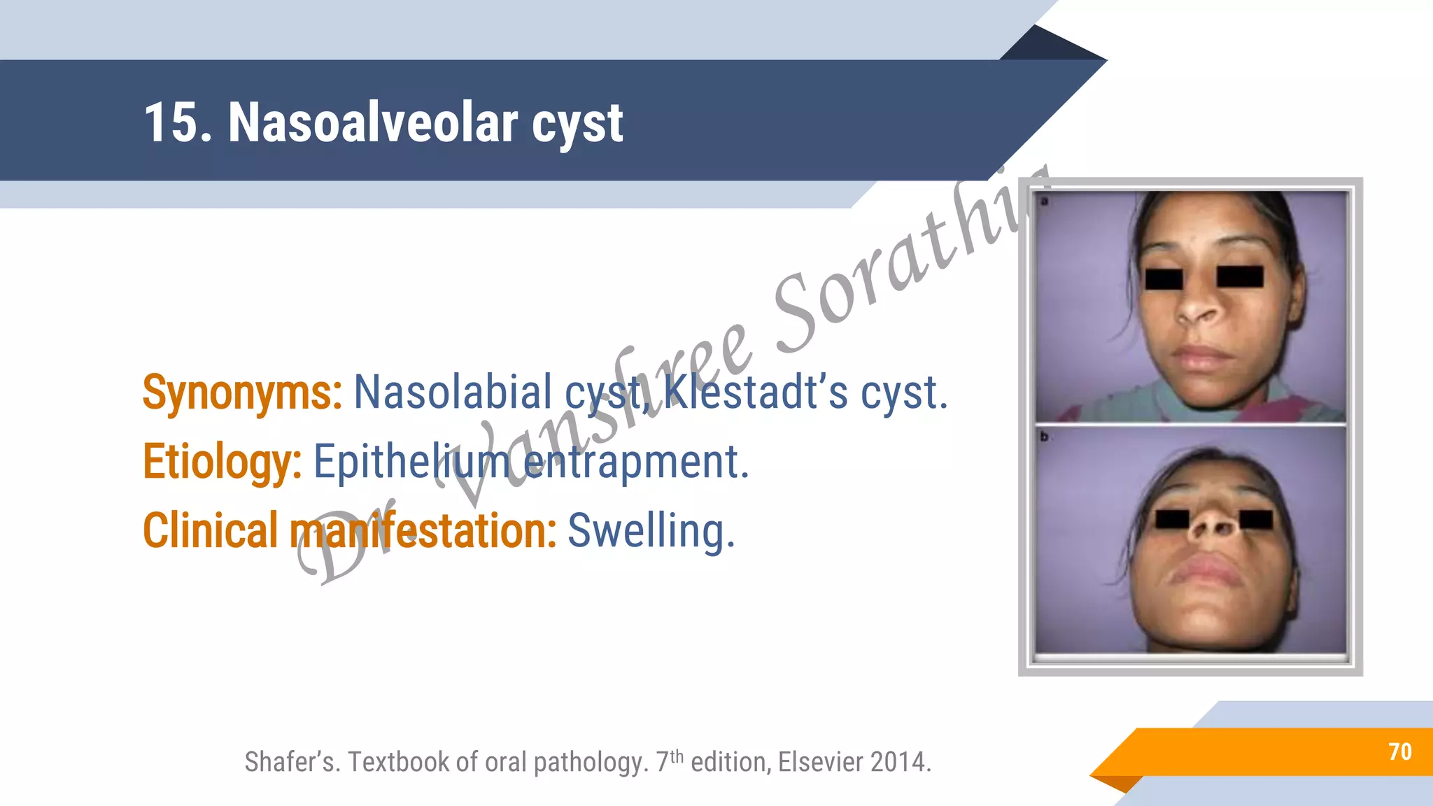 Embryology of Maxilla, Palate, Maxillary sinus & Lips and their Defects ...