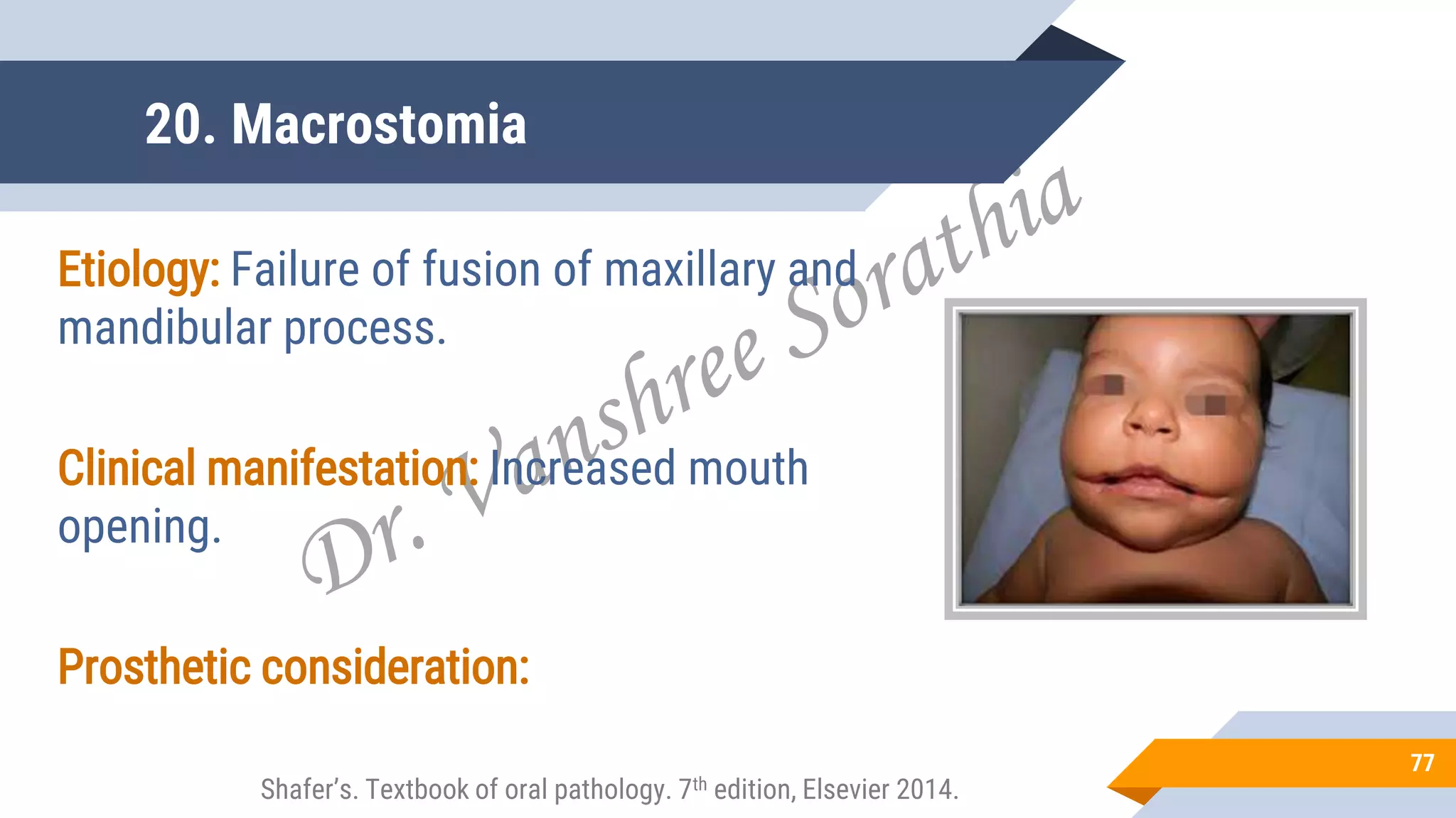 Embryology of Maxilla, Palate, Maxillary sinus & Lips and their Defects ...