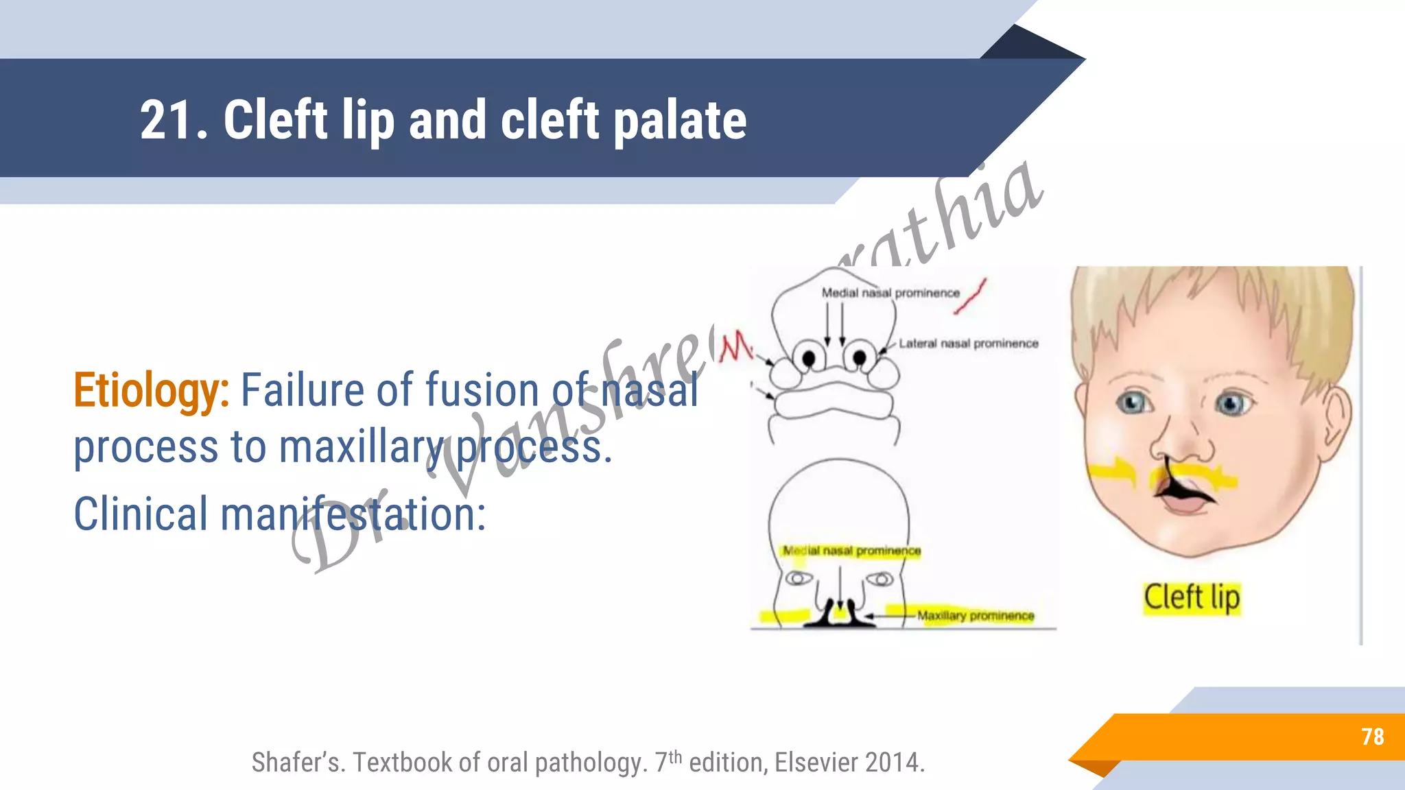 Embryology of Maxilla, Palate, Maxillary sinus & Lips and their Defects ...