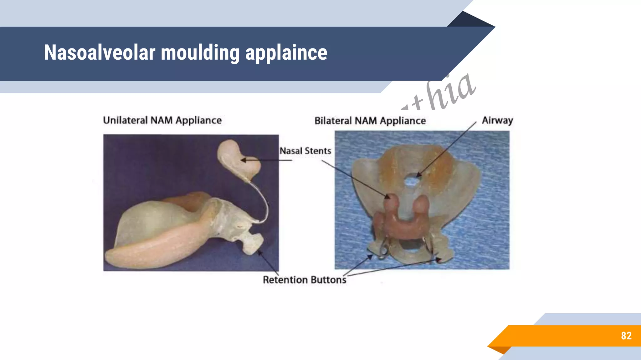 Embryology of Maxilla, Palate, Maxillary sinus & Lips and their Defects ...