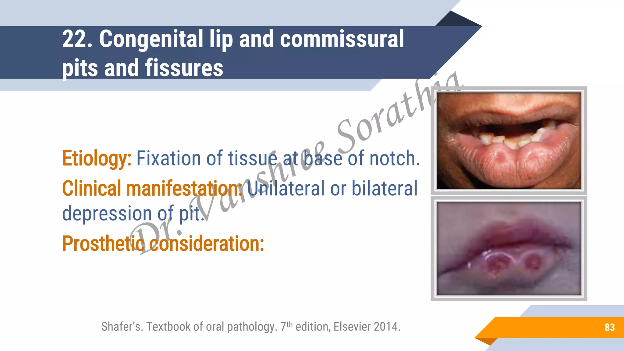 Embryology of Maxilla, Palate, Maxillary sinus & Lips and their Defects ...