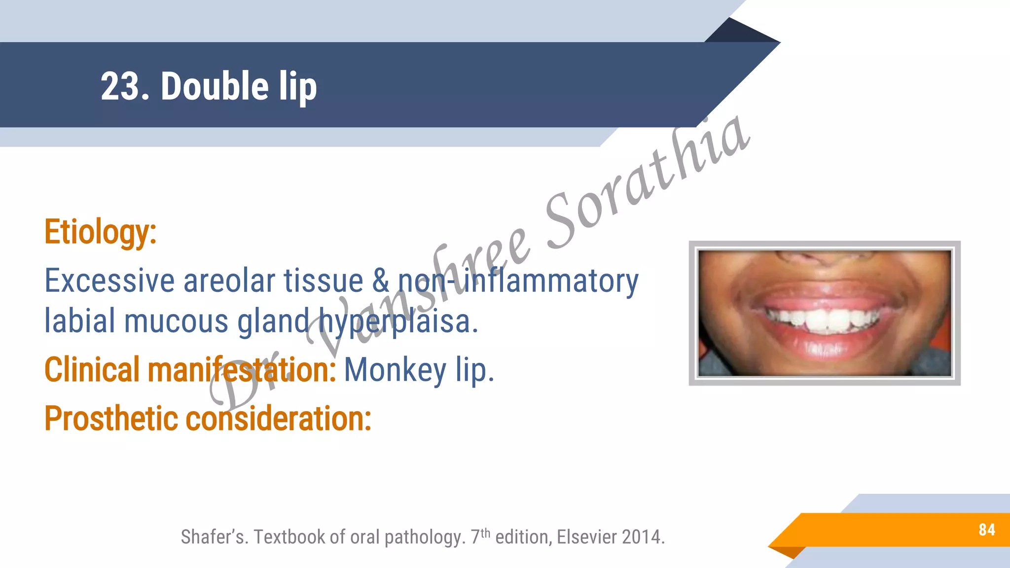 Embryology of Maxilla, Palate, Maxillary sinus & Lips and their Defects ...