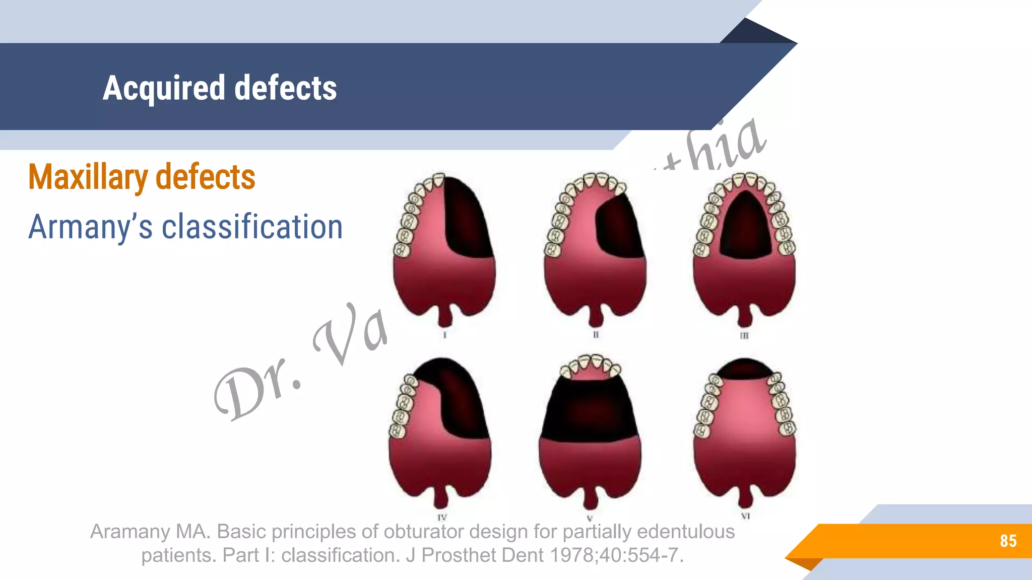 Embryology of Maxilla, Palate, Maxillary sinus & Lips and their Defects ...