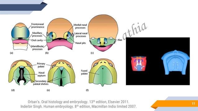 Embryology of Maxilla, Palate, Maxillary sinus & Lips and their Defects | PPTX | Ear, Nose and ...
