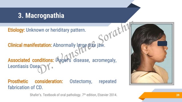 Embryology of Maxilla, Palate, Maxillary sinus & Lips and their Defects ...
