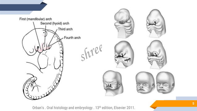 Embryology of Maxilla, Palate, Maxillary sinus & Lips and their Defects ...