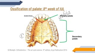 Embryology of Maxilla, Palate, Maxillary sinus & Lips and their Defects ...