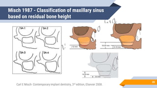 Embryology Of Maxilla, Palate, Maxillary Sinus Lips And, 41% OFF