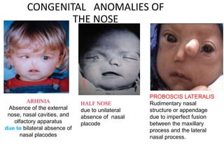 Embryology of nose 1440 copy | PPT