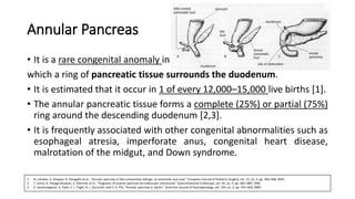 Annular Pancreas Embryology