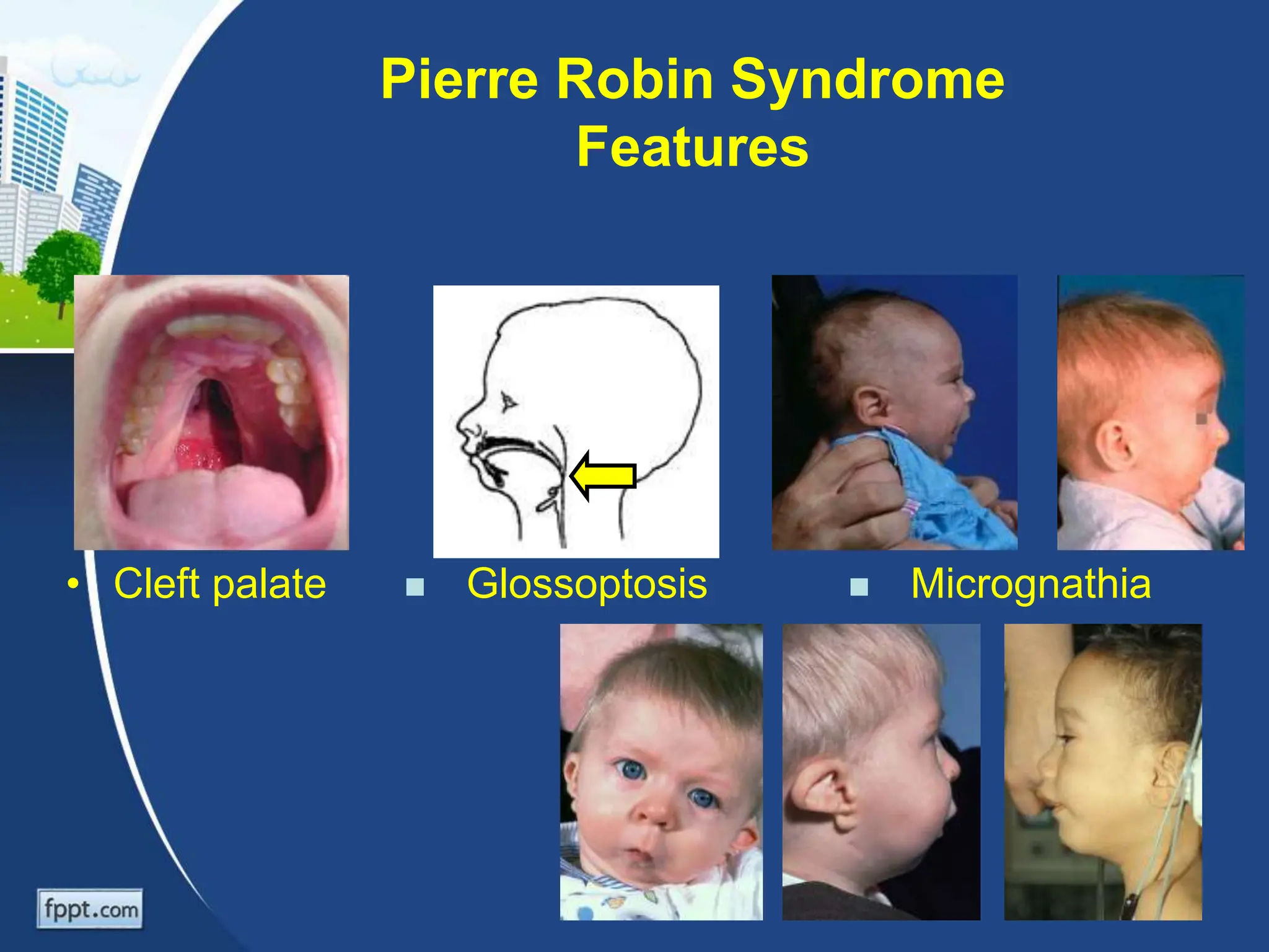 Embryology of Pharyngeal arches and it's clinical aspect.ppt