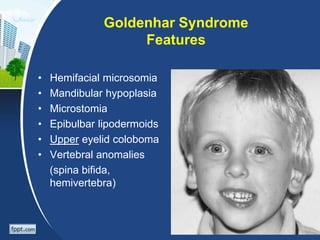 Embryology of Pharyngeal arches and it's clinical aspect.ppt