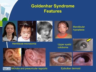 Embryology of Pharyngeal arches and it's clinical aspect.ppt