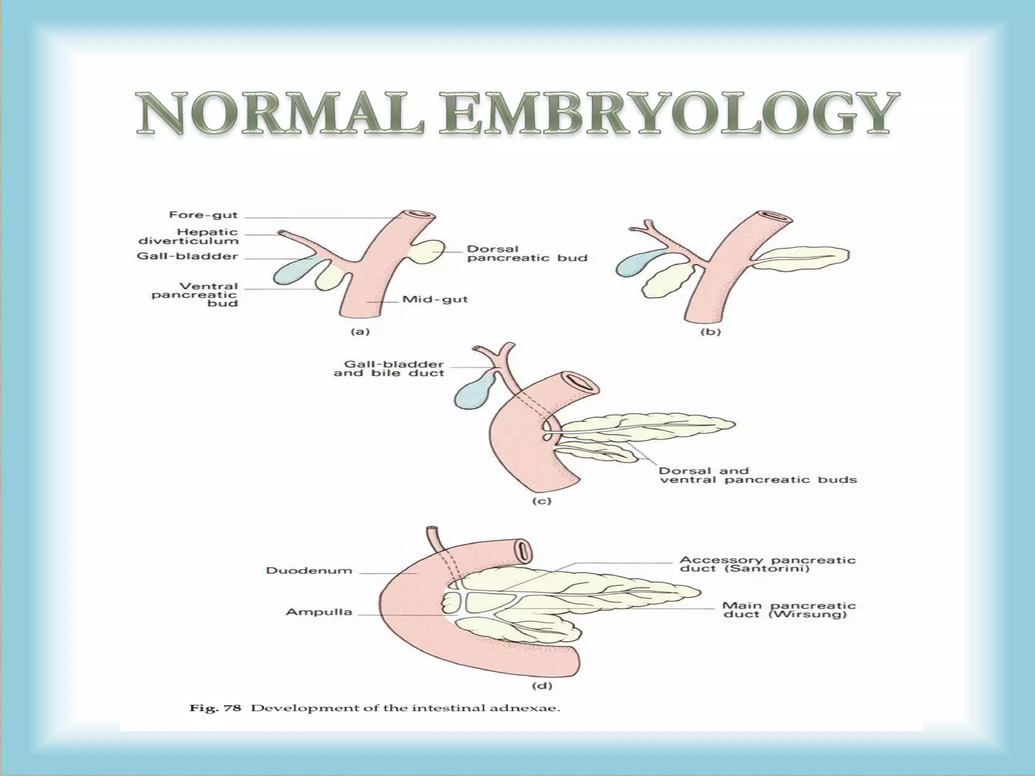 Embryology of pancreas and Imaging of pancreatitis | PPT