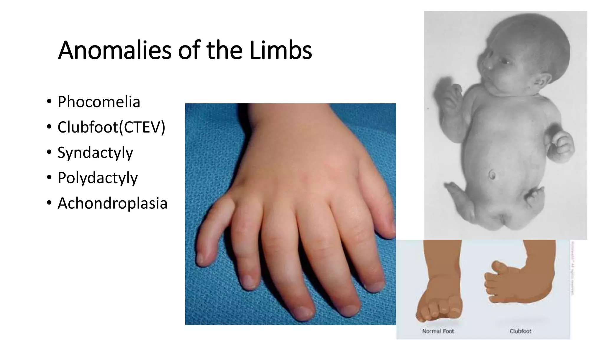 Embryology of skeletal system | PPT