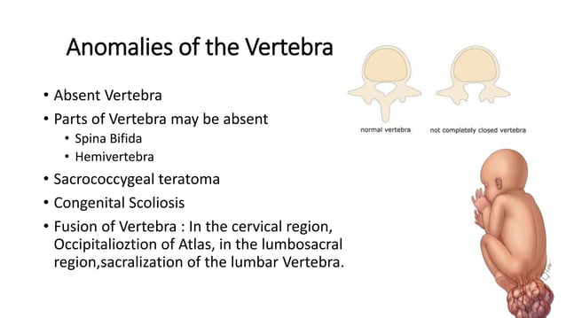 Embryology of skeletal system | PPT | Death, Injury, or Military ...