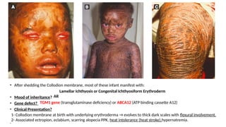 Embryology of Skin - Epidermal Development , Development of the ...