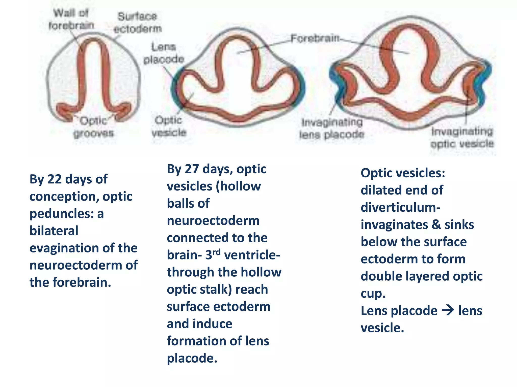 Embryology of the eye | PPTX