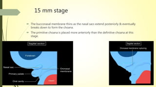 Embryology of the face, nose & pns beba | PPTX