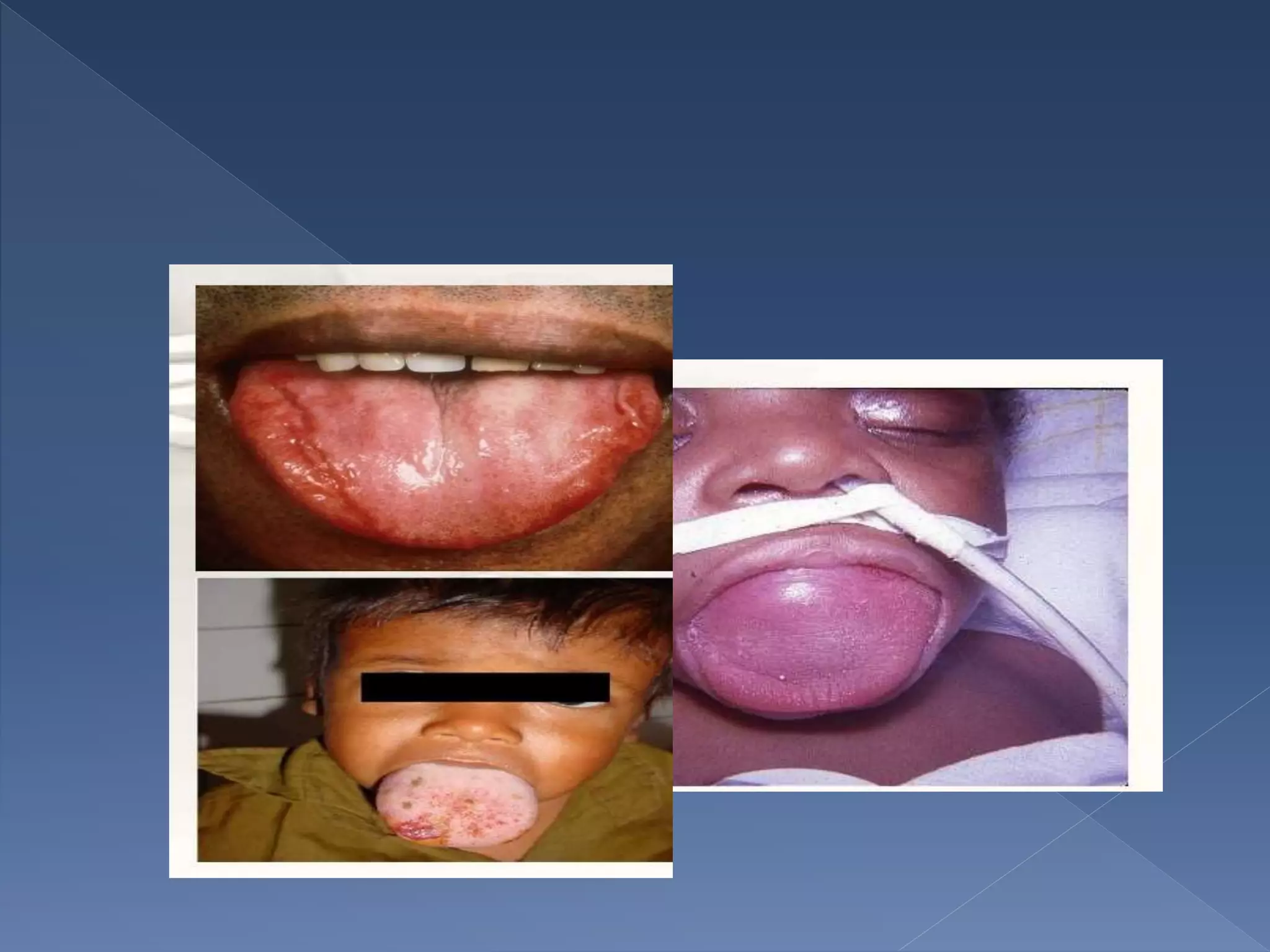 Embryology of tongue | PPTX