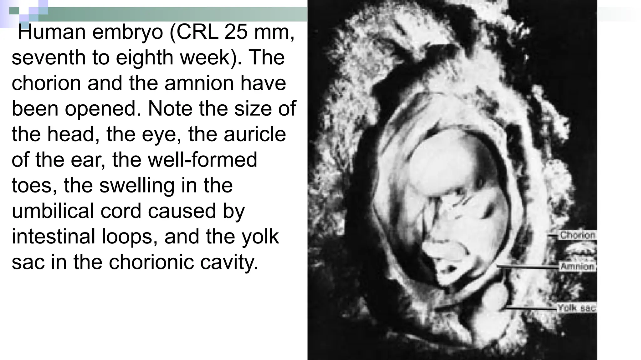 Embryology of Upper, lower limbs and the.pptx