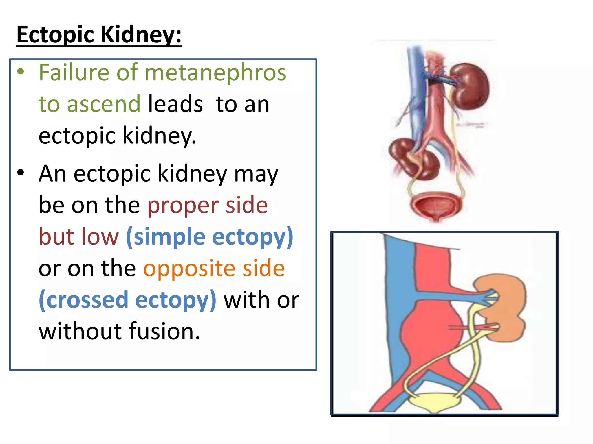 Embryology of Urinary System by Dr. Majid Kakakhel | PPT