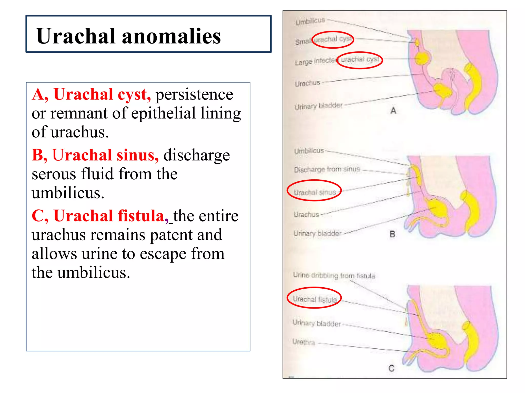 Embryology of Urinary System by Dr. Majid Kakakhel | PPT