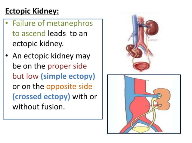 Embryology of Urinary System by Dr. Majid Kakakhel | PPT