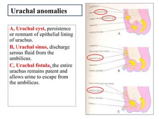 Embryology of Urinary System by Dr. Majid Kakakhel | PPT