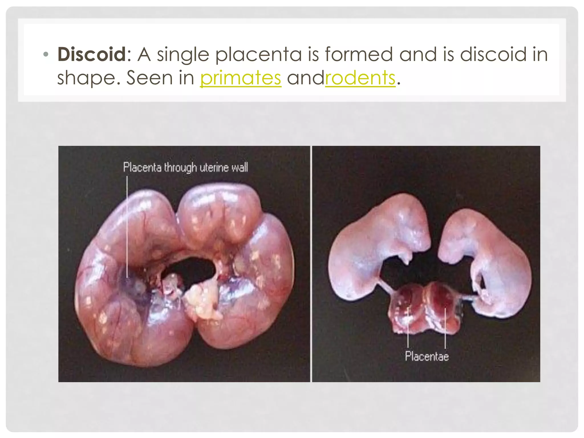 histology of Embryology placenta | PDF