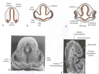 Embryology of Eye | PPTX