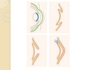 Embryology of Eye | PPTX