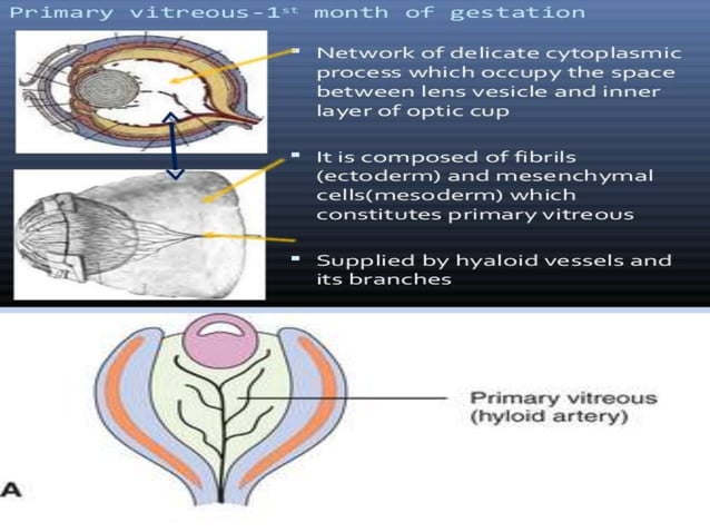 Vitreous | PPT