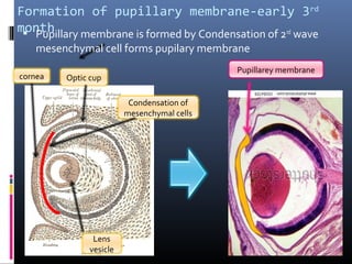 Embryology of human eye | PPT