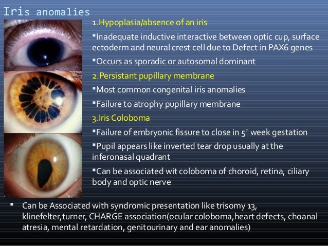 Embryology of human eye