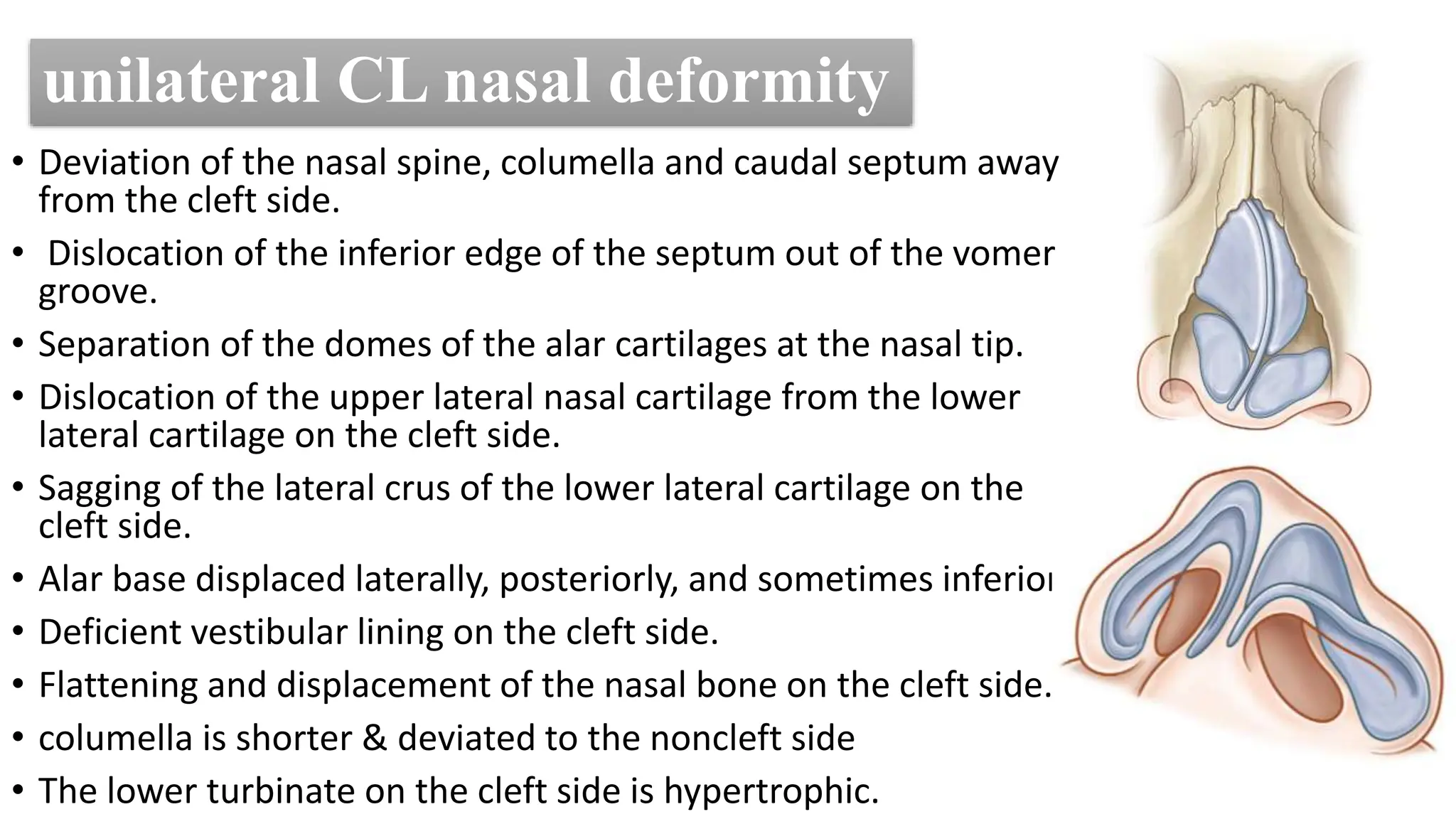 Embryology & Surgical Anatomy of Cleft Lip.pptx