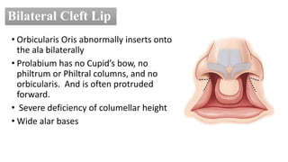 Embryology & Surgical Anatomy of Cleft Lip.pptx