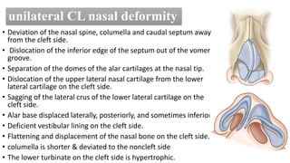 Embryology & Surgical Anatomy of Cleft Lip.pptx